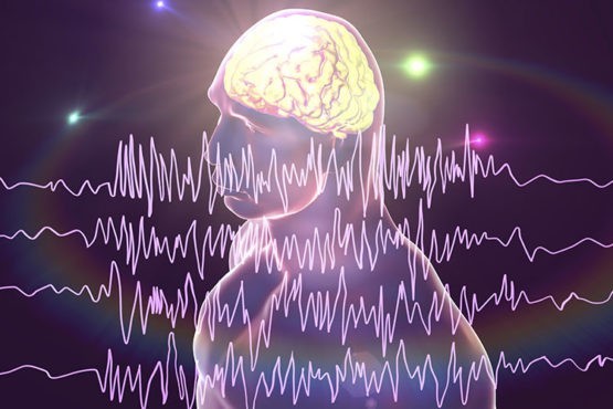 Symptoms, Treatment, and Help for Seizures.