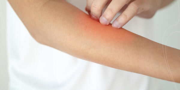 Types of Neurological Disorders That Affect The Skin