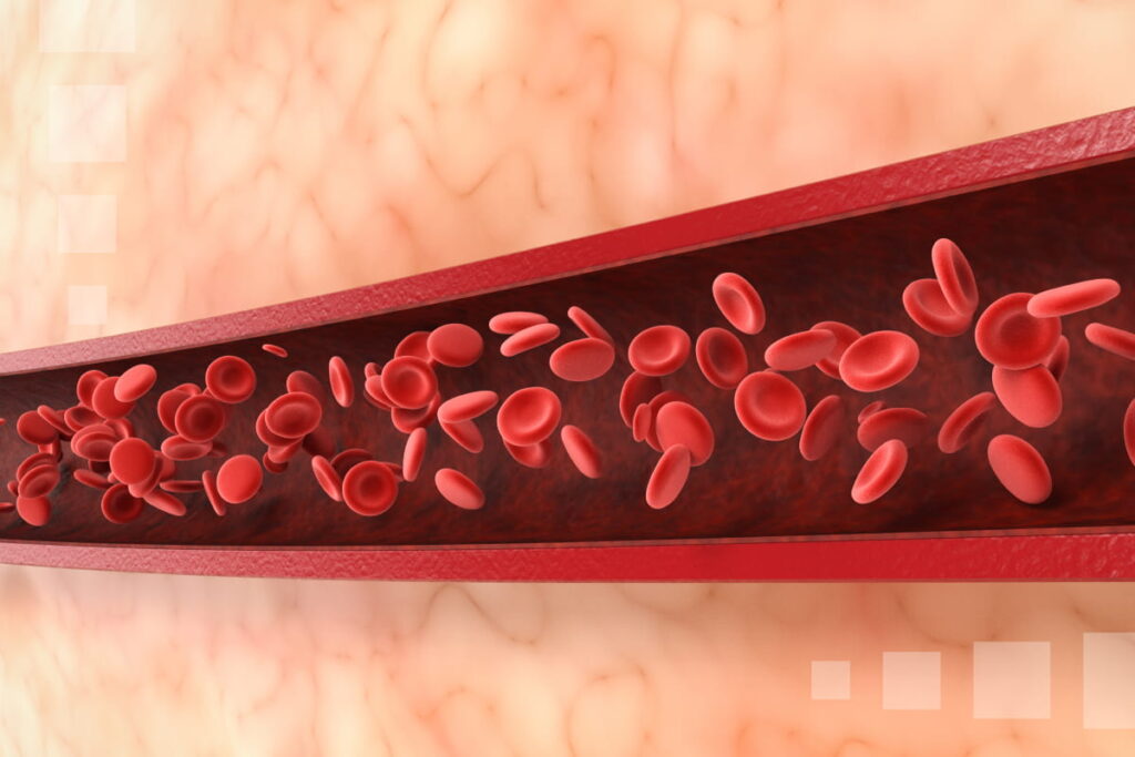 What are blood vessel disorders? - Lone Star Neurology
