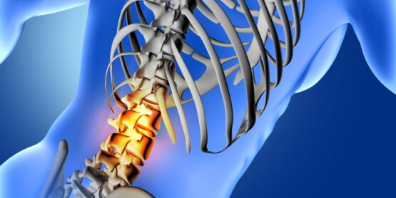 Lower back pain - Lone Star Neurology