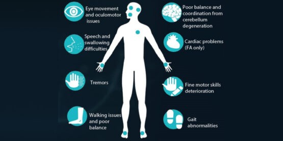 Friedreich Ataxia - Lone Star Neurology