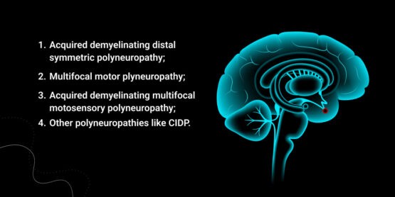 CIDP: Symptoms, Causes and Treatment