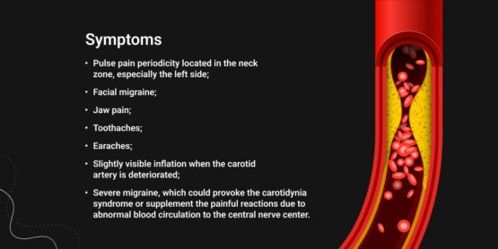 Carotidynia - Symptoms, Causes and Diagnosis