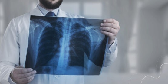 Radiculitis: Symptoms, Causes, Types and Treatment