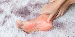 Foot Drop: Signs, Symptoms, and Causes Explained