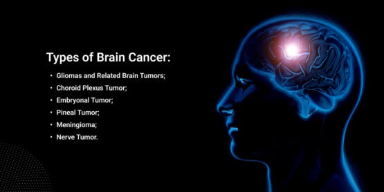Causes & Types of Brain Cancer | Lone Star Neurology