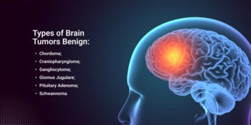 Causes & Types of Brain Cancer | Lone Star Neurology