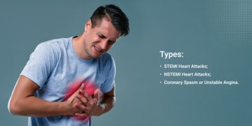 Types of Heart Attack: Causes, Symptoms, Treatment
