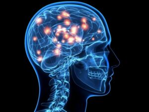Broca's Area Damage: Treatment | Lone Star Neurology