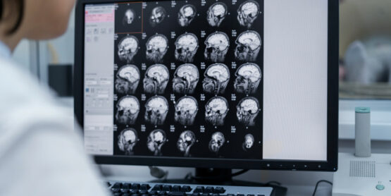 MRI for Brain Damage Detection: Key Points