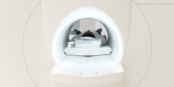 Cervical Disc Herniation: Insights from MRI Scans