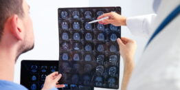 Top 3 Rare Neurological Disorders You Should Know