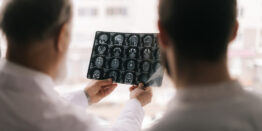 Chronic Traumatic Encephalopathy (CTE) Overview