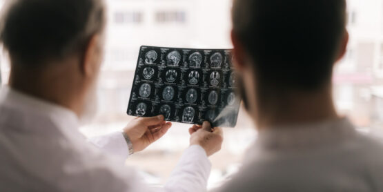 Chronic Traumatic Encephalopathy (CTE) Overview