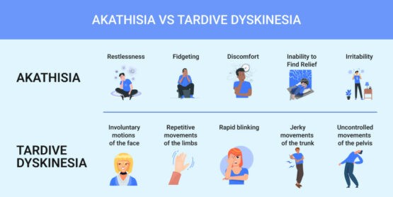 Akathisia vs Tardive Dyskinesia - Lone Star Neurology