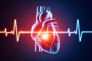 Myocardial Infarction: STEMI vs NSTEMI - Lone Star Neurology