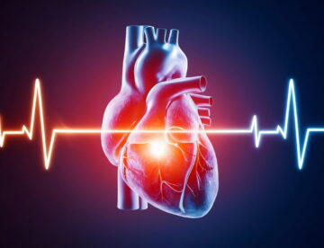 What is NSTEMI? (non-ST Elevation Myocardial Infarction)