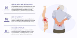 Bechterew's disease: symptoms and treatment options