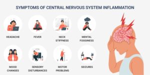 Chronic Inflammation & Neurological Diseases: Key Insights
