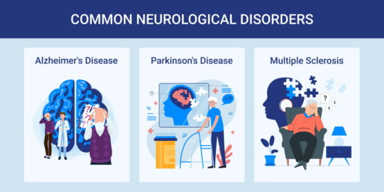 Top 3 Common Neurological Disorders: Symptoms & Treatments