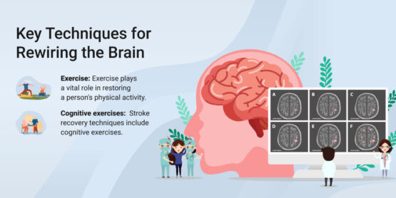 Rewiring the Brain After Stroke: Recovery Solutions
