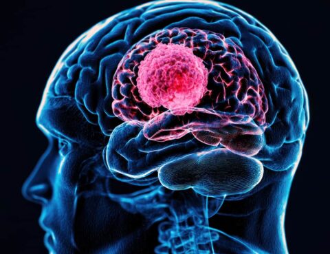 Frontal Lobe Damage: Symptoms, Causes and Diagnostics