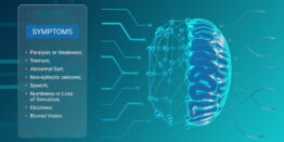 Understanding FND: Myths vs. Facts Explained