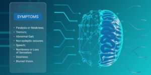Understanding FND: Myths vs. Facts Explained