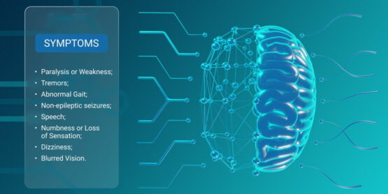 Understanding FND: Myths vs. Facts Explained