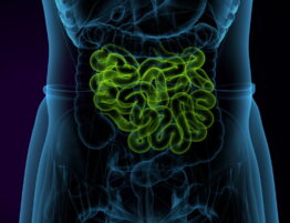 What is Oculocephalic Reflex (Doll's eyes)?