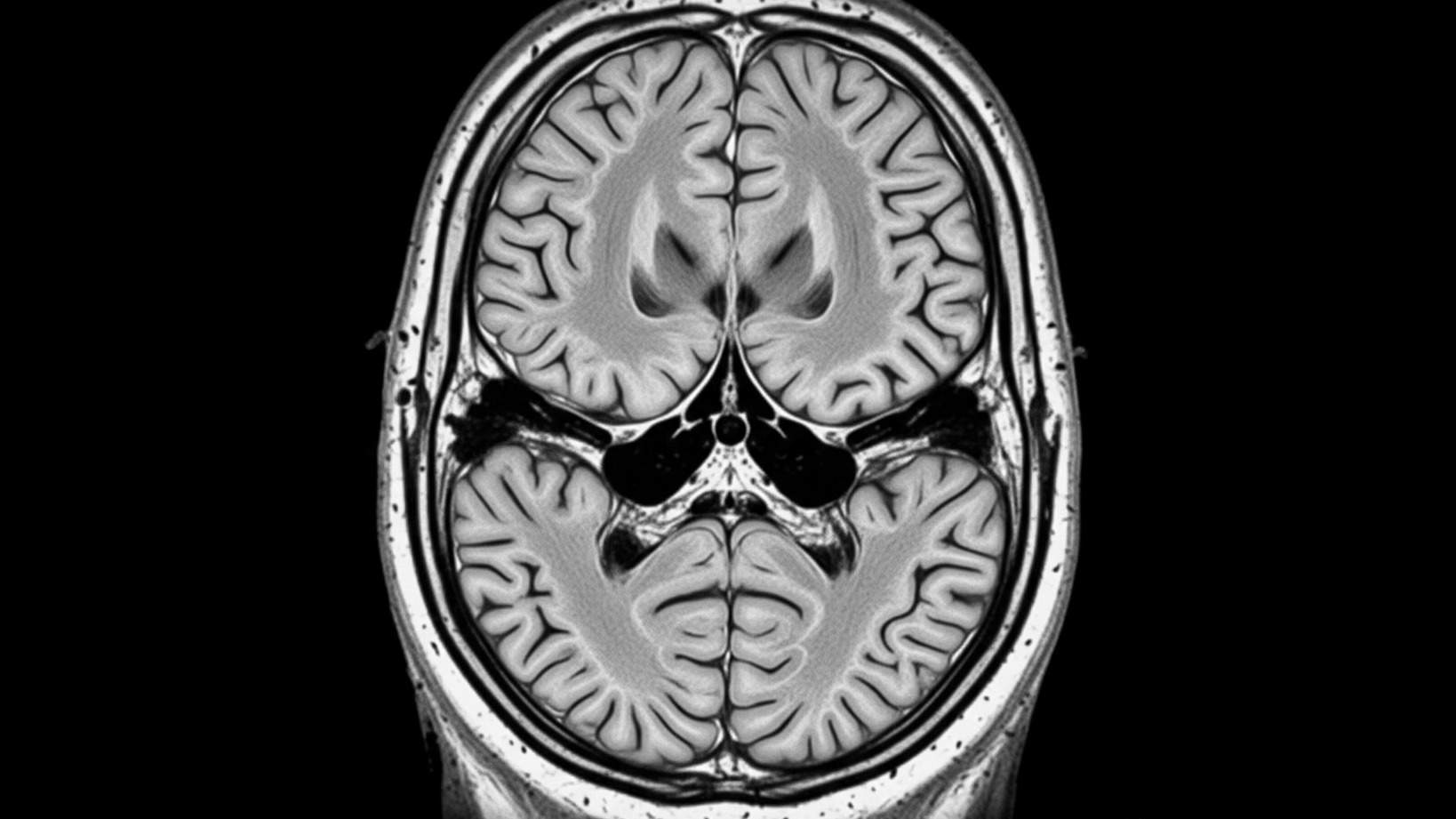 How Functional MRI Is Enhancing Our Understanding