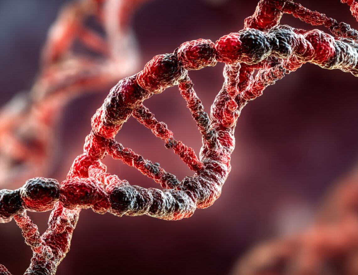 Arnold Chiari Syndrome: Causes and Symptoms